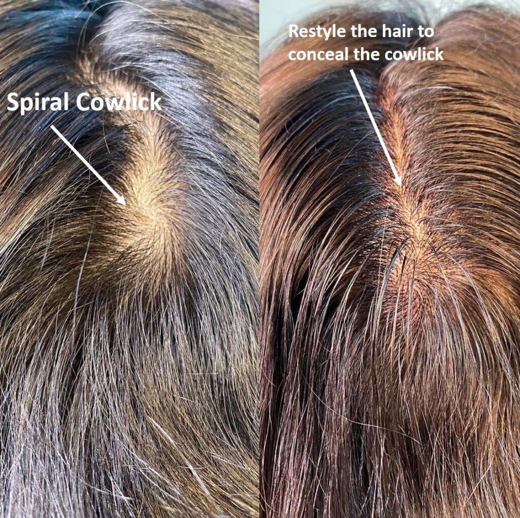 Why Do I Have A Cowlick In The Back Of My Head POPULAR MEN S HAIRCUTS Why Do I Have A Cowlick In The Back Of My Head POPULAR MEN S HAIRCUTS